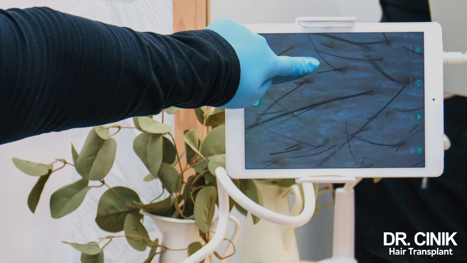 Alcol e caduta dei capelli: guida medica completa | Dr Cinik